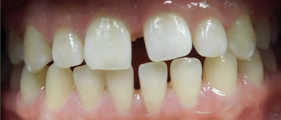 Home - Success Smiles Orthodontics