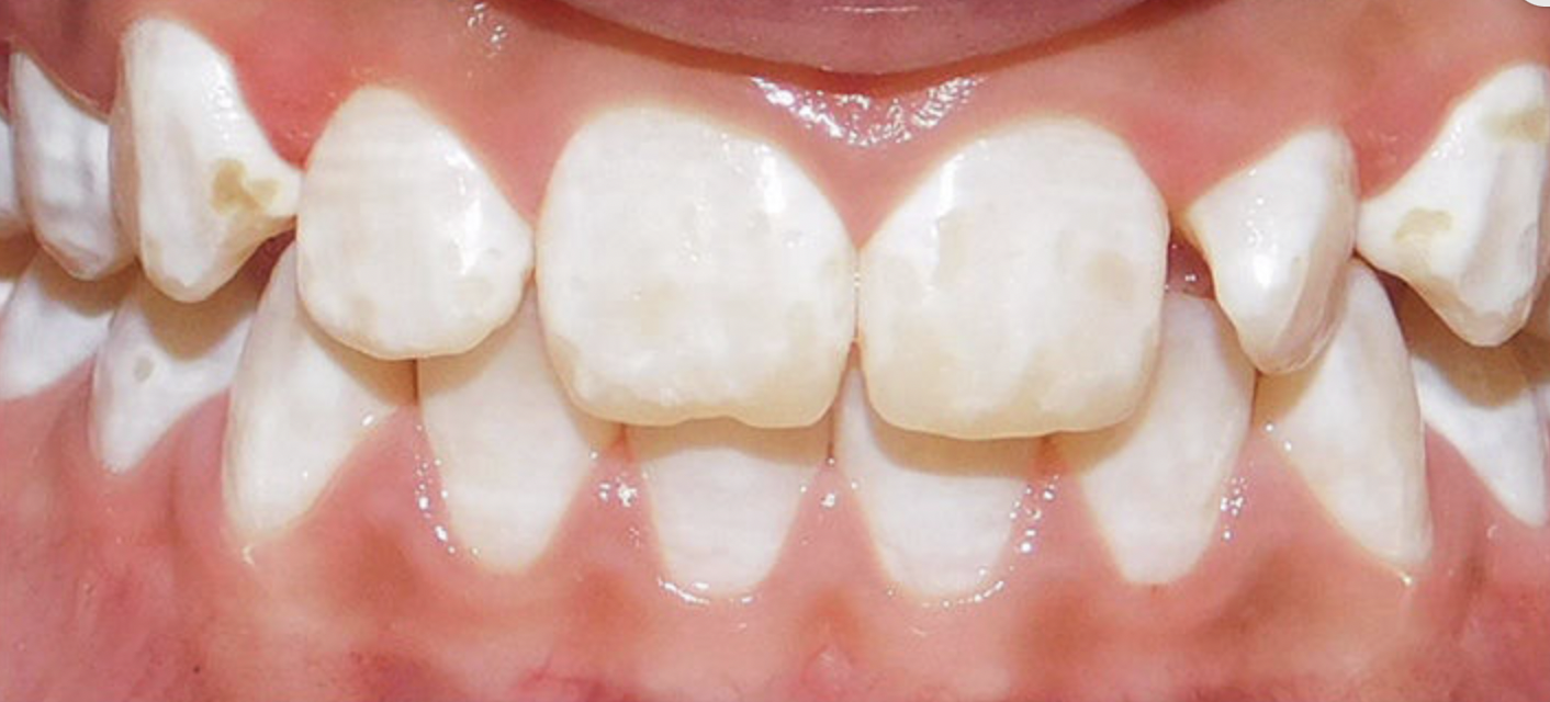 Home - Success Smiles Orthodontics