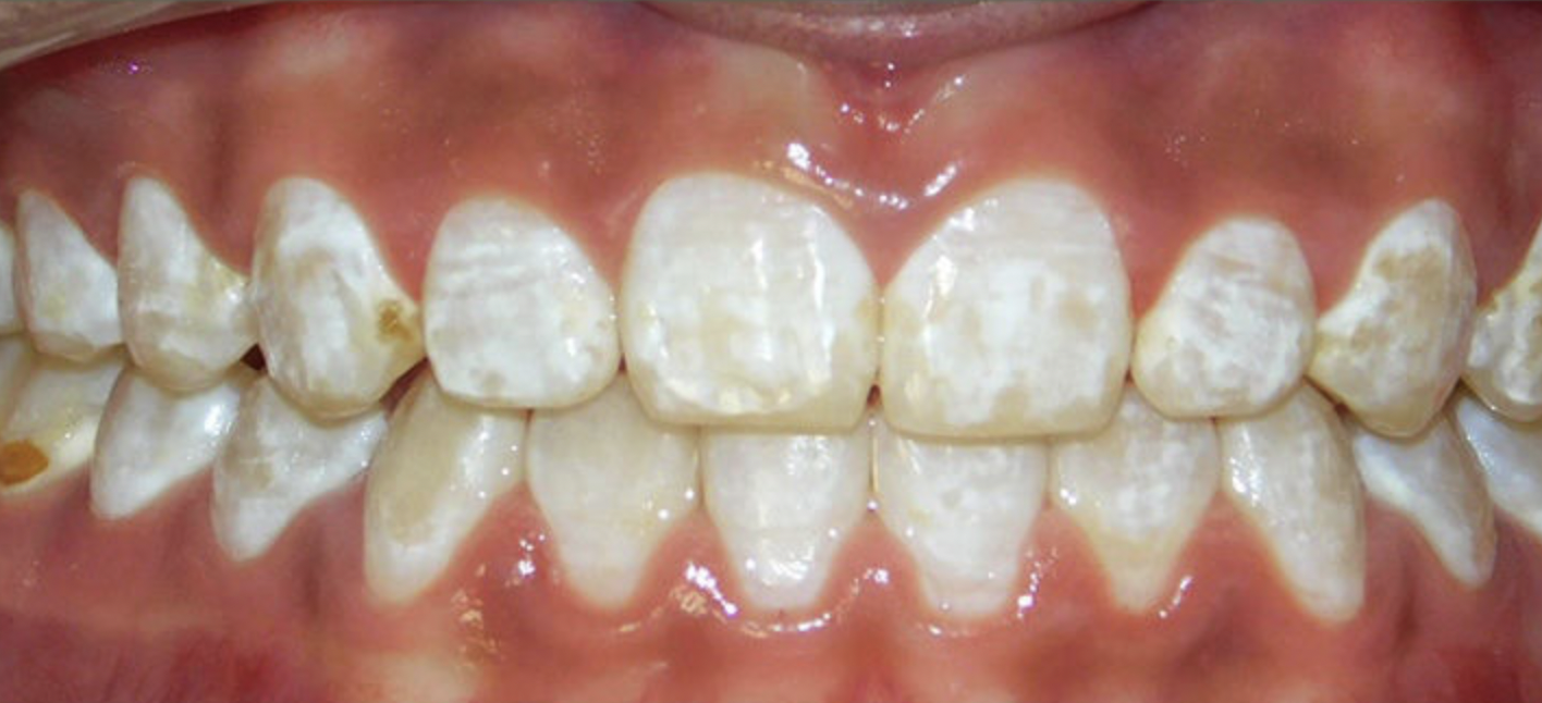 Home - Success Smiles Orthodontics