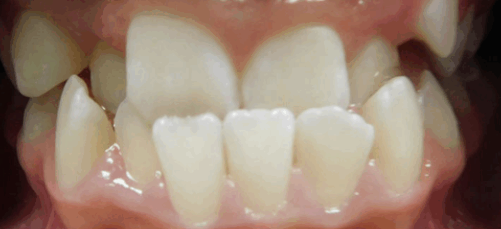 Home - Success Smiles Orthodontics