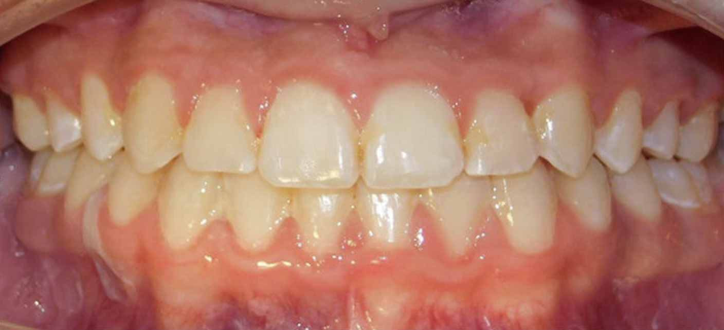 Home - Success Smiles Orthodontics