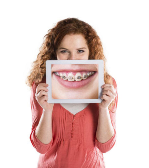 Orthodontic Services - Success Smiles Orthodontics